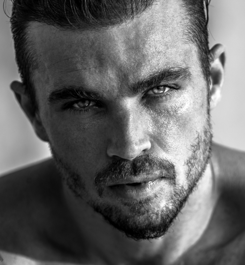 Blepharoplasty for men – attractive yet masculine eyes – Anti Age and ...