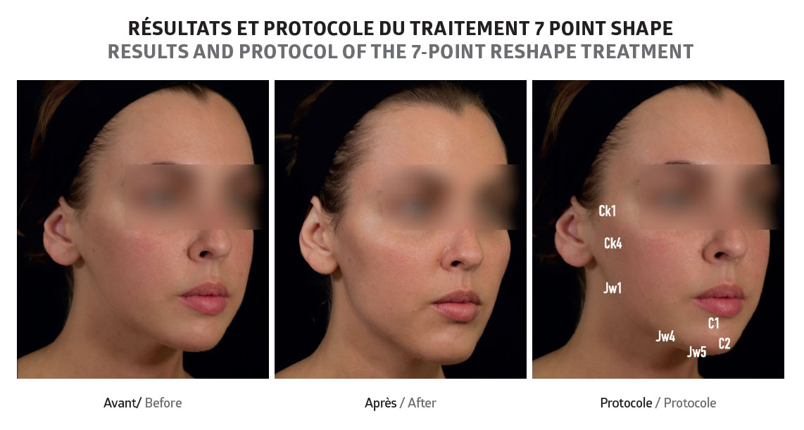 marchac-7point-shape – Anti Age Magazine