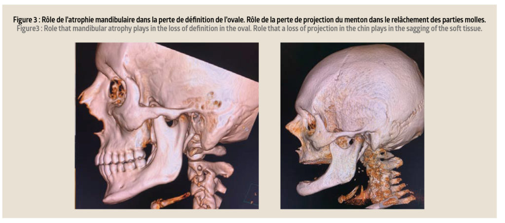 The concept of structural facial aesthetics – Anti Age Magazine