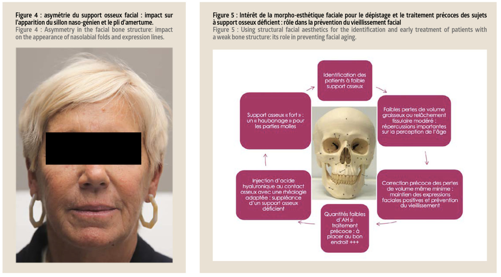 The concept of structural facial aesthetics – Anti Age Magazine