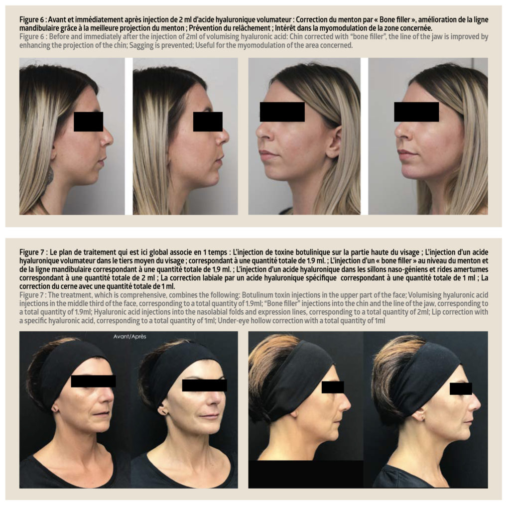 The concept of structural facial aesthetics – Anti Age and Longevity ...